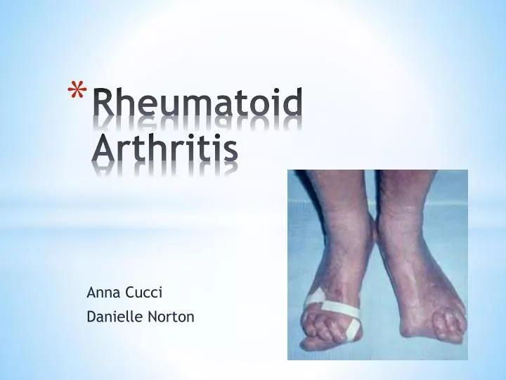 PPT - Rheumatoid Arthritis PowerPoint Presentation, free download - ID ...