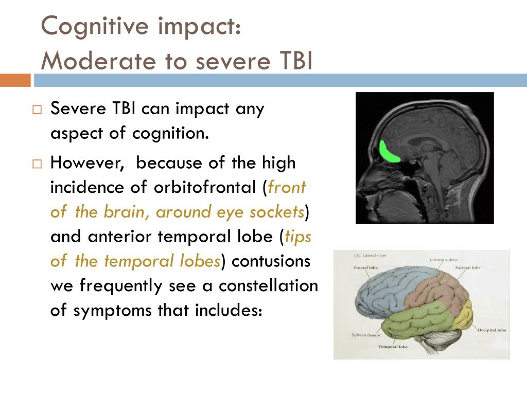 PPT - Traumatic Brain Injury (TBI) Outcomes July, 2013 PowerPoint ...