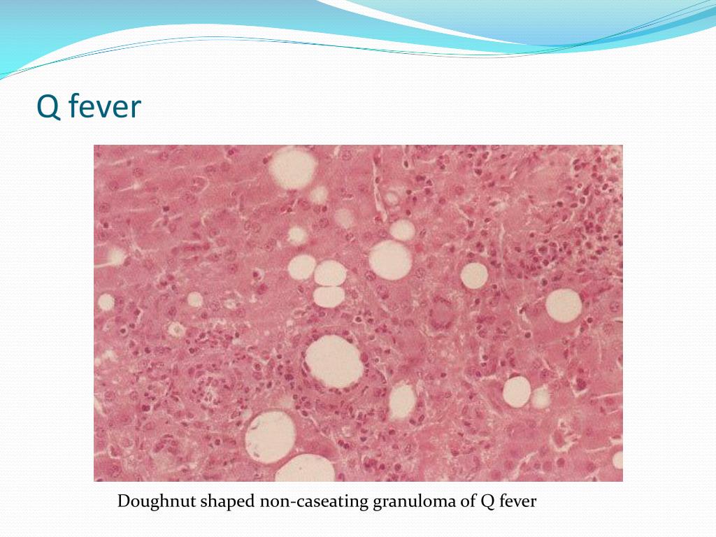 PPT - Rickettsial (Spotted & Typhus Fevers) & Related Infections ...