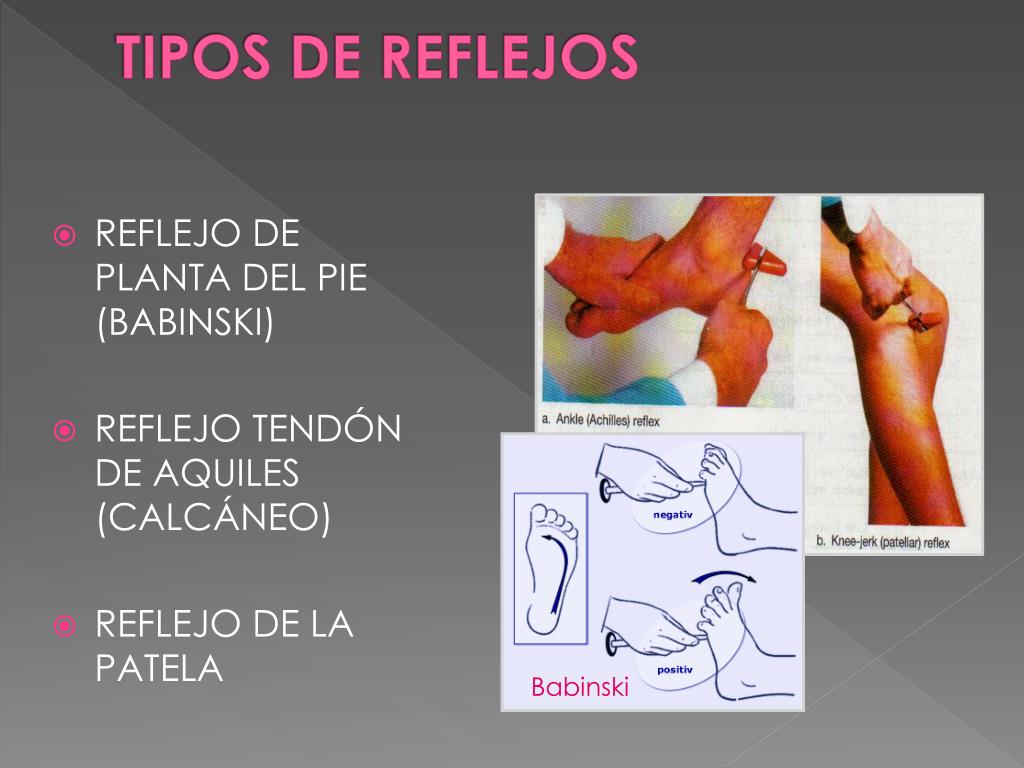 PPT - ARCO REFLEJO. REFLEJO CONDICIONADO. REFLEJO MIOTATICO PowerPoint ...