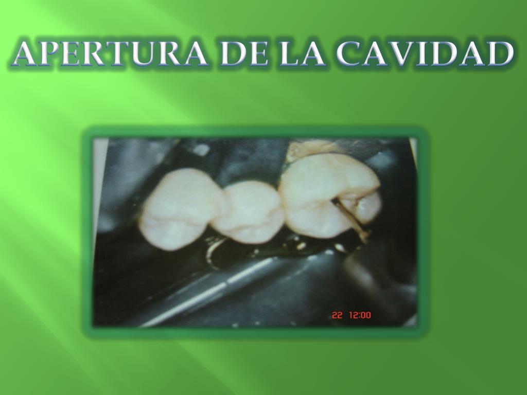 PPT - NUEVOS CONCEPTOS DE DISEÑO DE CAVIDADES PowerPoint Presentation ...