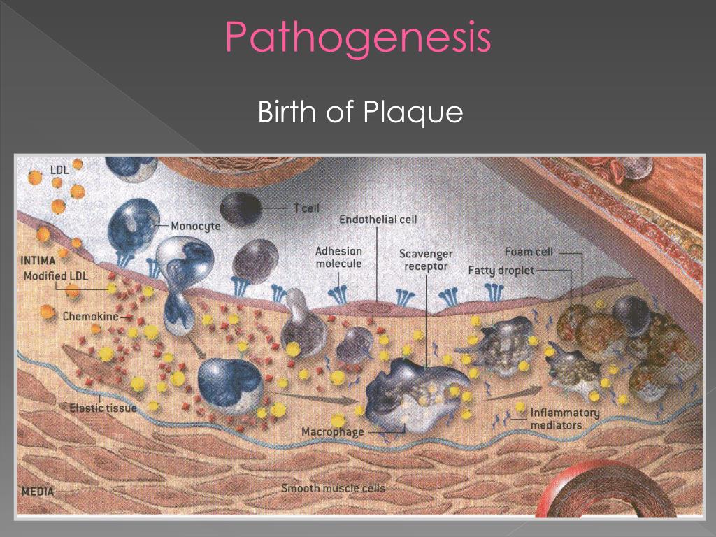 PPT - ISCHAEMIC HEART DISEASE Pathophysiology And Stable Angina ...