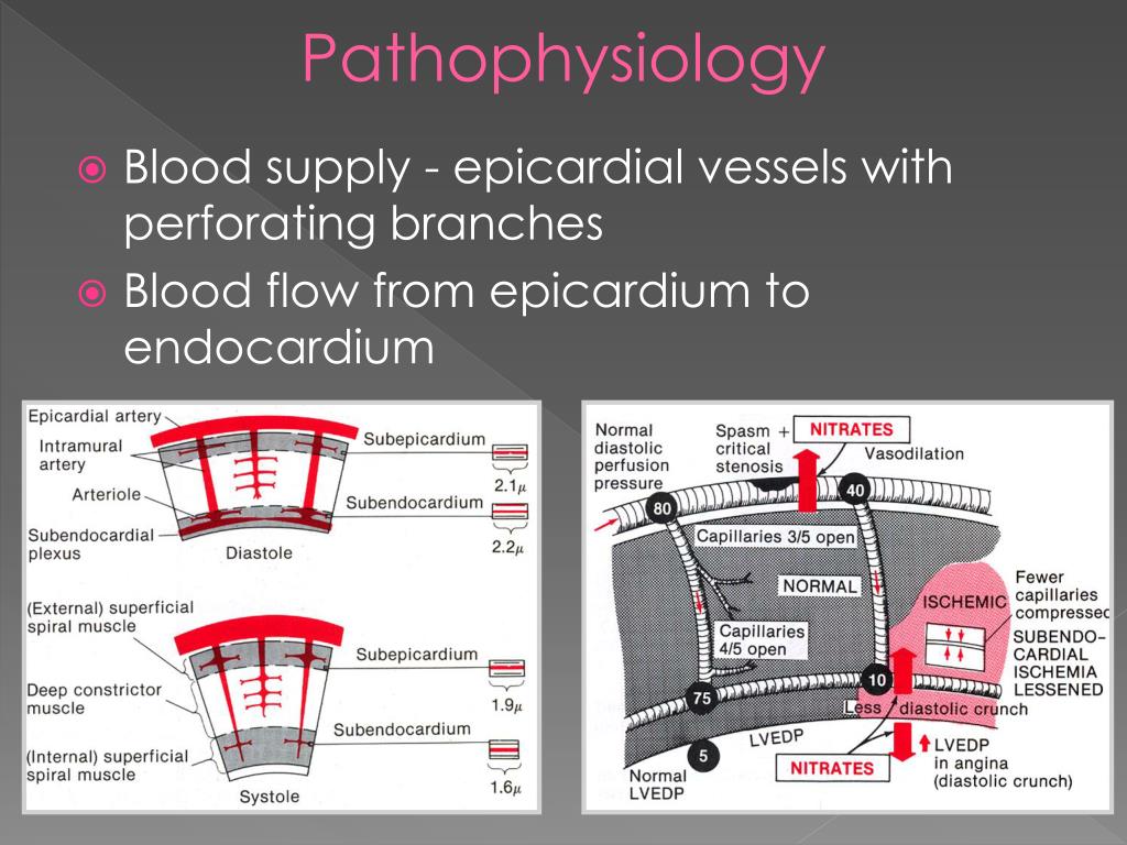PPT - ISCHAEMIC HEART DISEASE Pathophysiology And Stable Angina ...