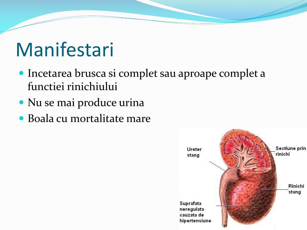 PPT - Boli ale sistemului excretor la om PowerPoint Presentation, free ...