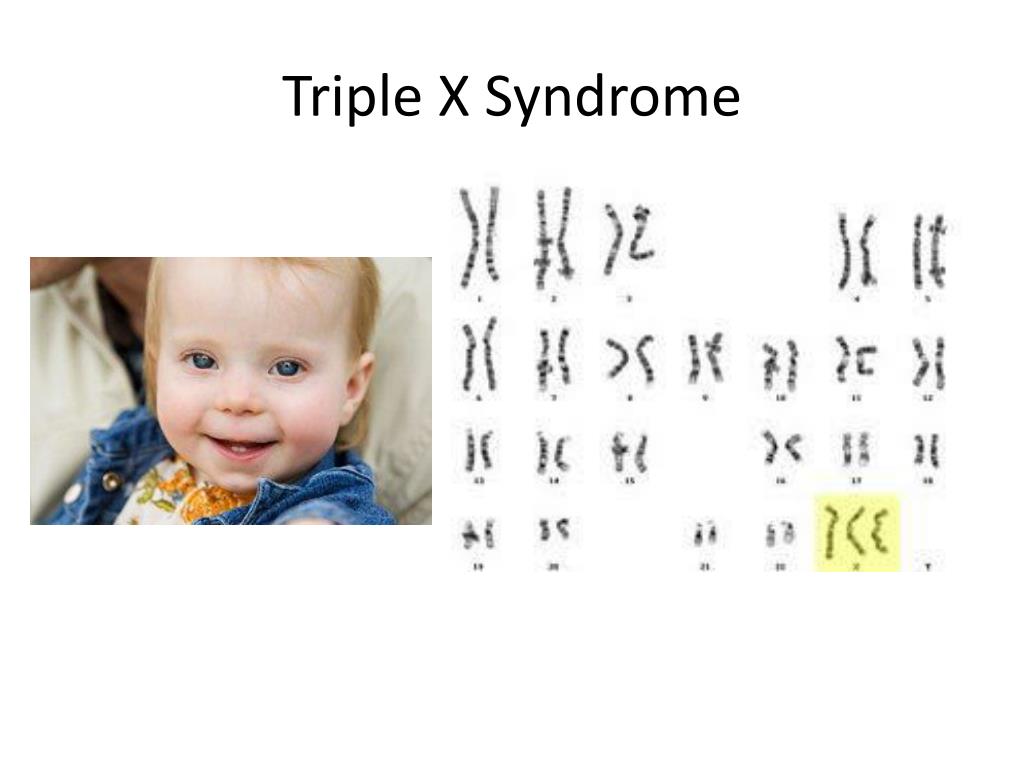 PPT - Human Sex Chromosome Abnormalities PowerPoint Presentation, free ...
