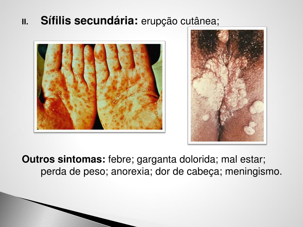 PPT - “ The Tuskegee Study ” ou Estudo da Sífilis Não-Tratada de ...