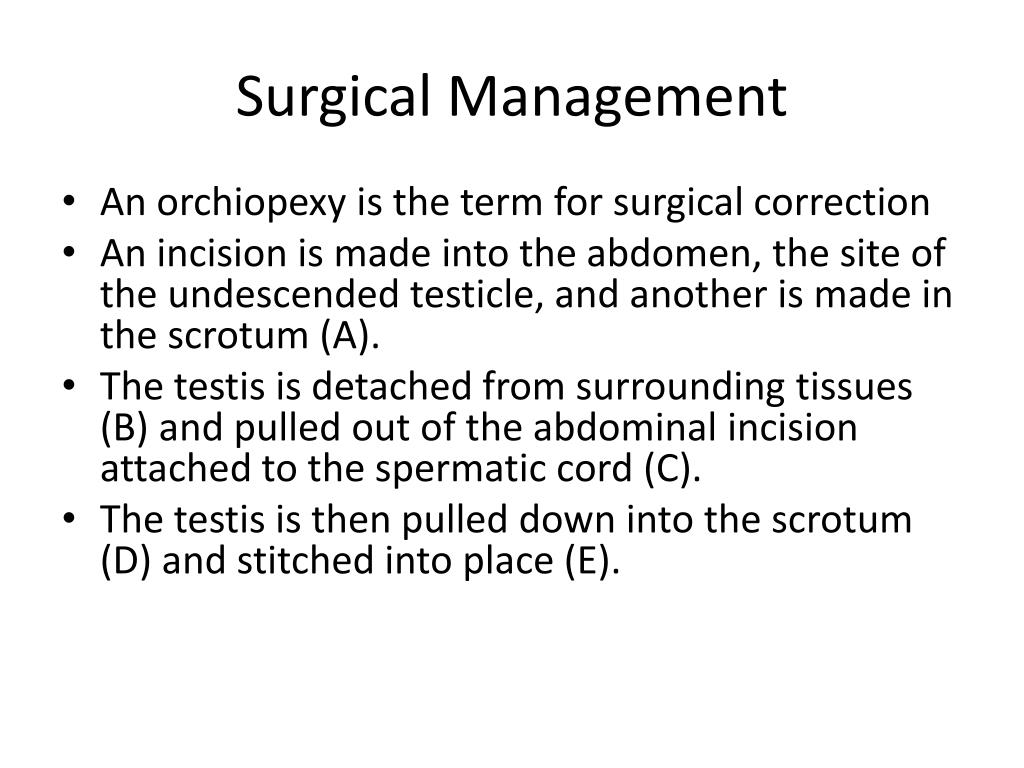 Ppt Hypospadias Hydrocele Cryptorchidism Powerpoint Presentation