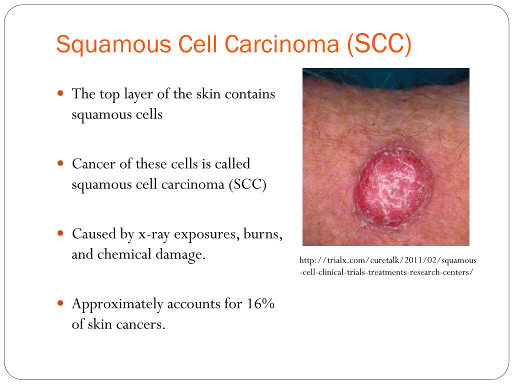 PPT - Visual Inspection with Acetic Acid (VIA) for Skin Cancer ...