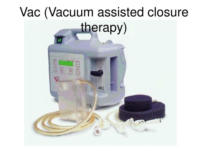 PPT - Wound care PowerPoint Presentation - ID:2881896