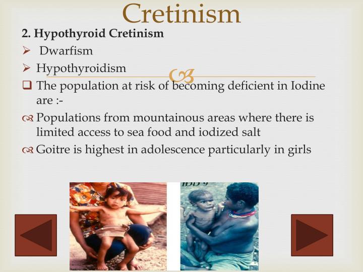 PPT - Common Nutrient Deficiency Diseases among U nder-five Children ...