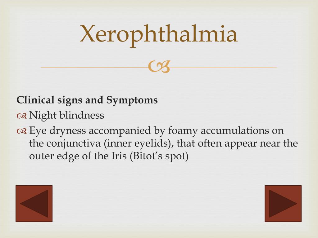 PPT - Common Nutrient Deficiency Diseases among U nder-five Children ...
