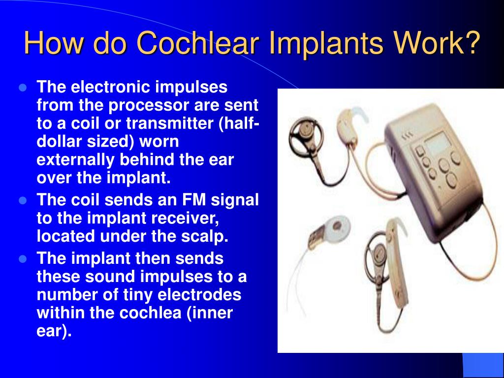 PPT - Children & Cochlear Implants Psychological Evaluation of Implant ...