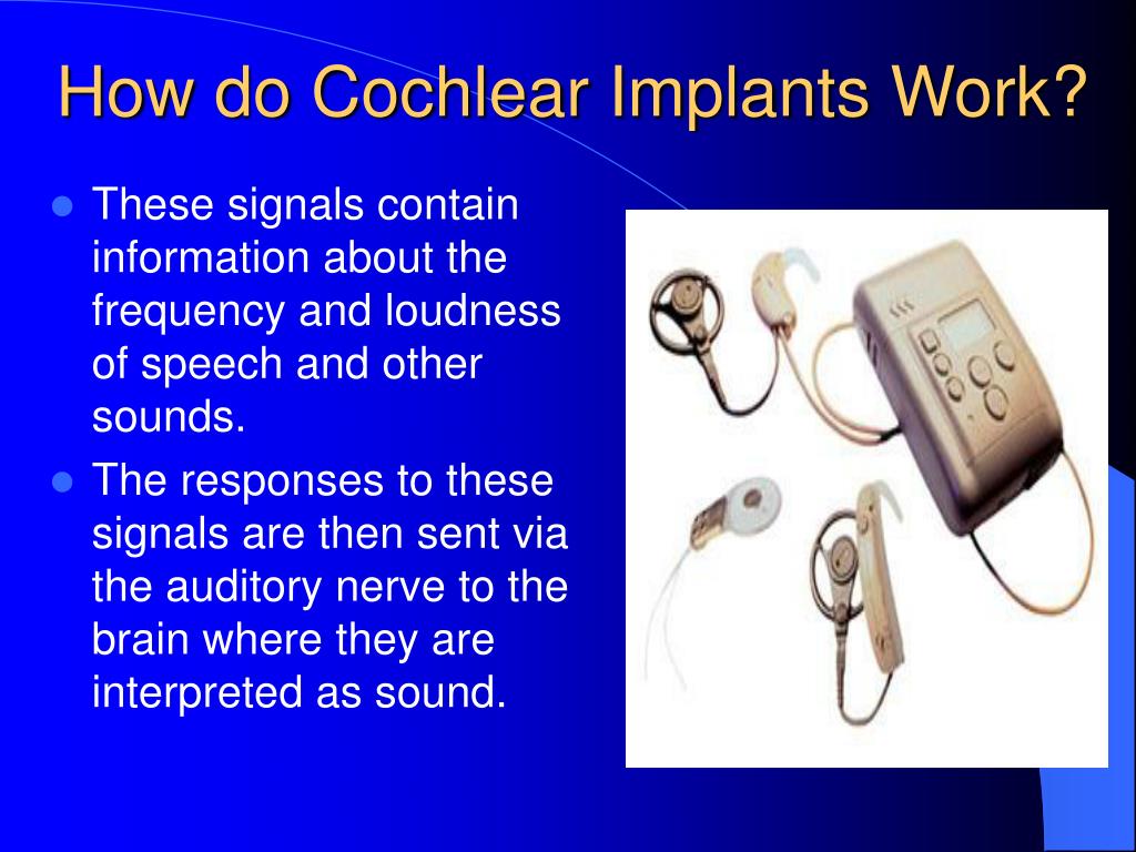 PPT - Children & Cochlear Implants Psychological Evaluation of Implant ...