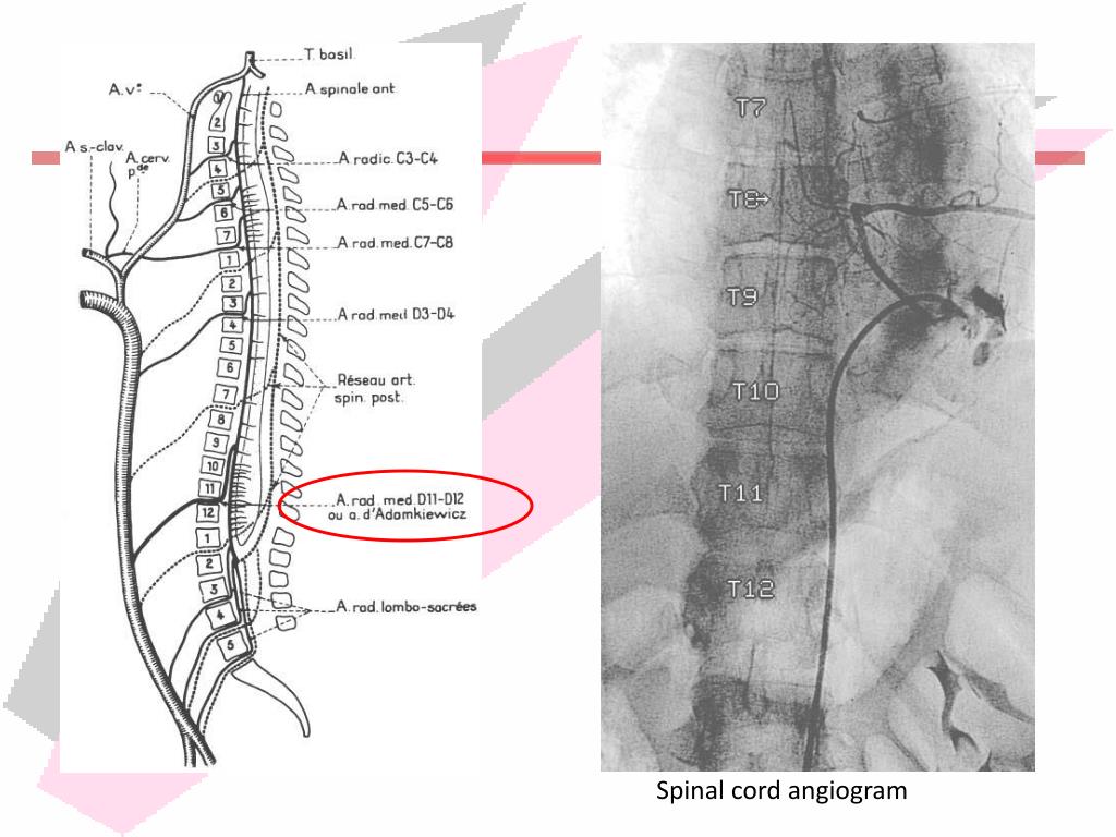 PPT - Vascular and Endovascular Surgery Division University of Florence ...