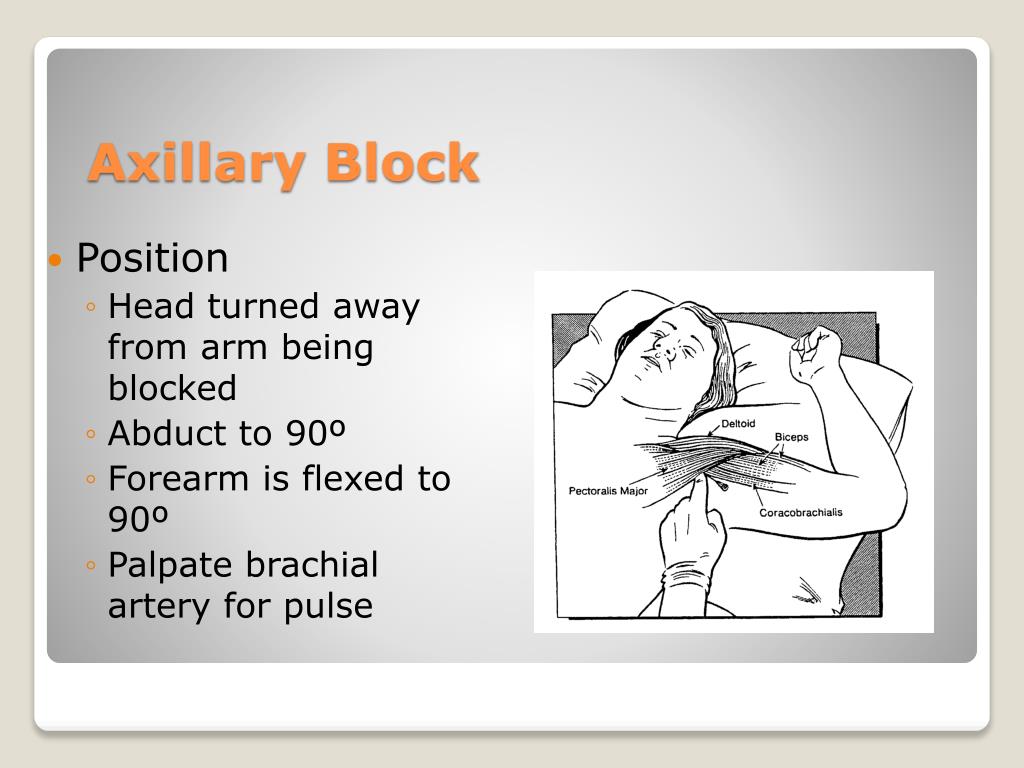 PPT - Regional Anesthesia Spinal &epidural Anesthesia Dr.hamidreza ...