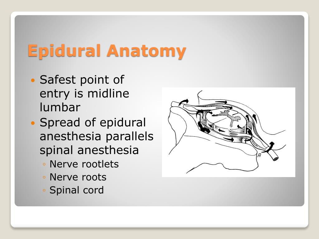 PPT - Regional Anesthesia Spinal &epidural Anesthesia Dr.hamidreza ...