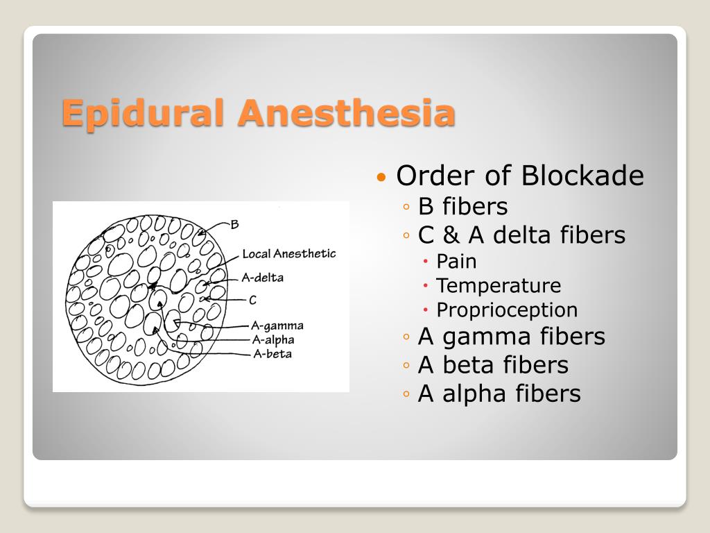 PPT - Regional Anesthesia Spinal &epidural Anesthesia Dr.hamidreza ...