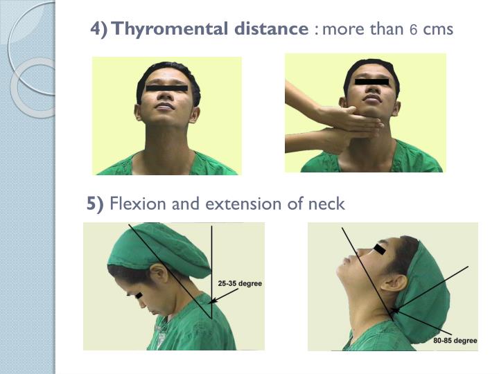 PPT - Airway intubation PowerPoint Presentation - ID:2894259