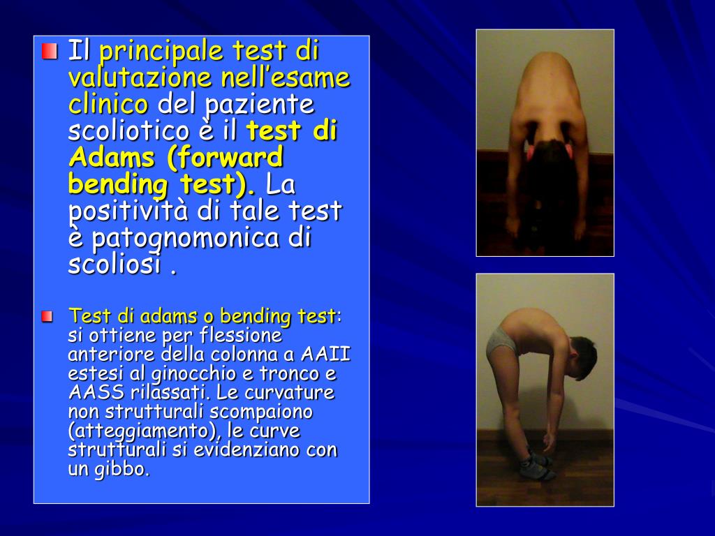 PPT - Evoluzione assetto posturale e funzione motoria nel bambino ...