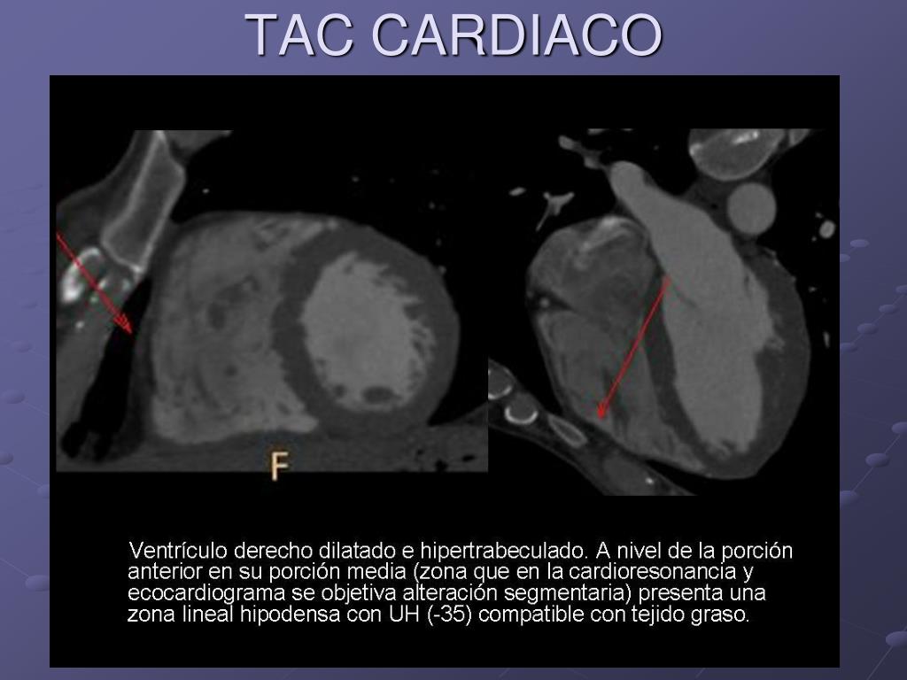 PPT - Dificultades diagnósticas en la… PowerPoint Presentation, free ...