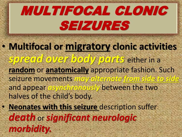 PPT - Seizures in Neonates PowerPoint Presentation - ID:2911751