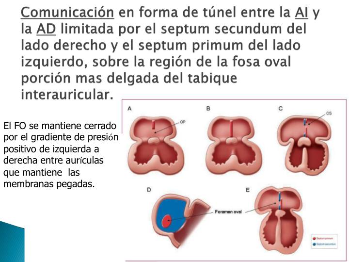 PPT - FORAMEN OVAL PERMEABLE PowerPoint Presentation - ID:2915271