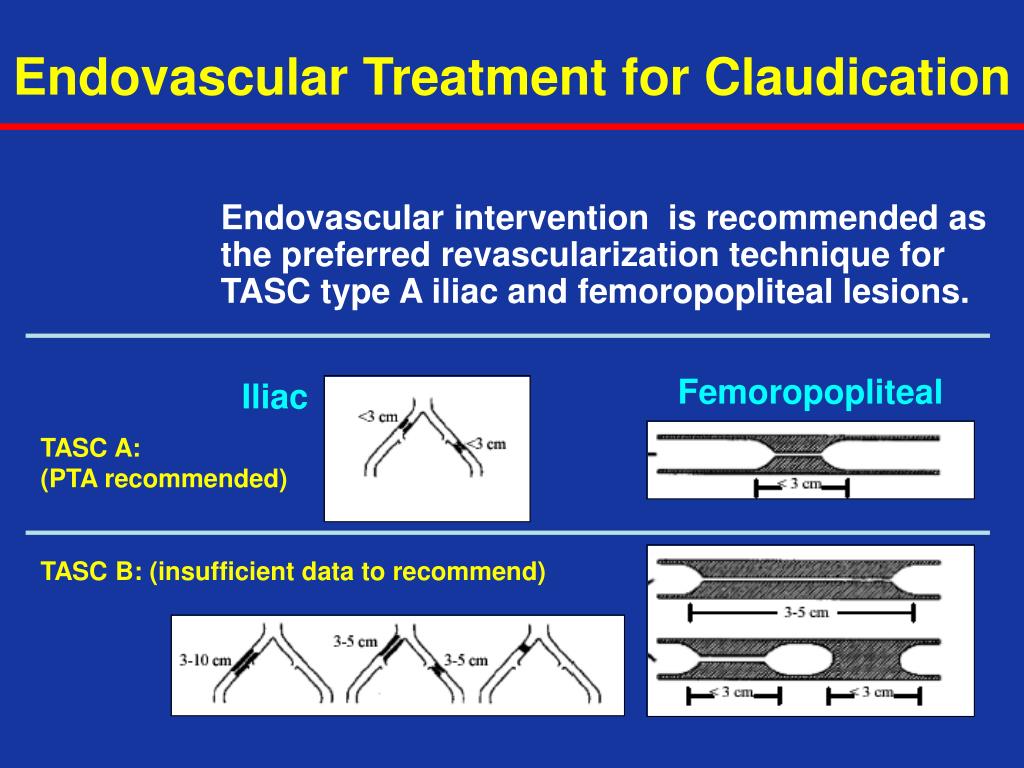 PPT - Peripheral Arterial Disease Guidelines: Management of Patients ...