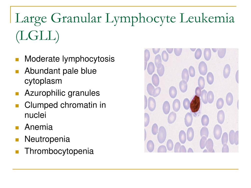 PPT - MLAB 1415- Hematology Keri Brophy-Martinez PowerPoint ...