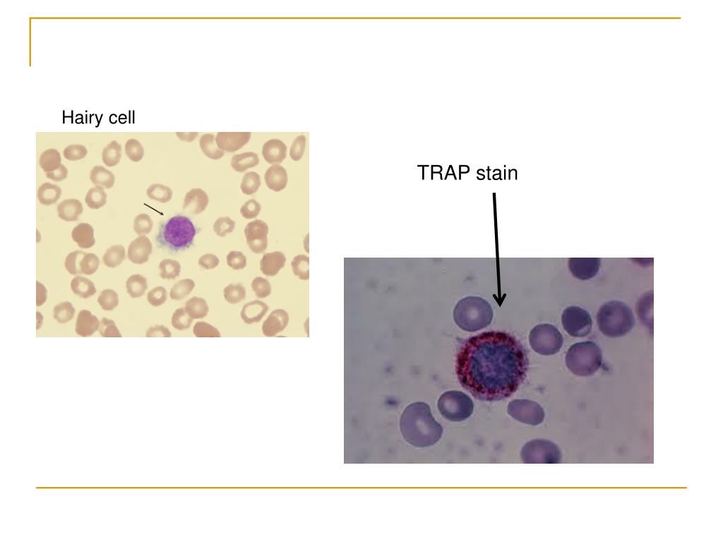 PPT - MLAB 1415- Hematology Keri Brophy-Martinez PowerPoint ...