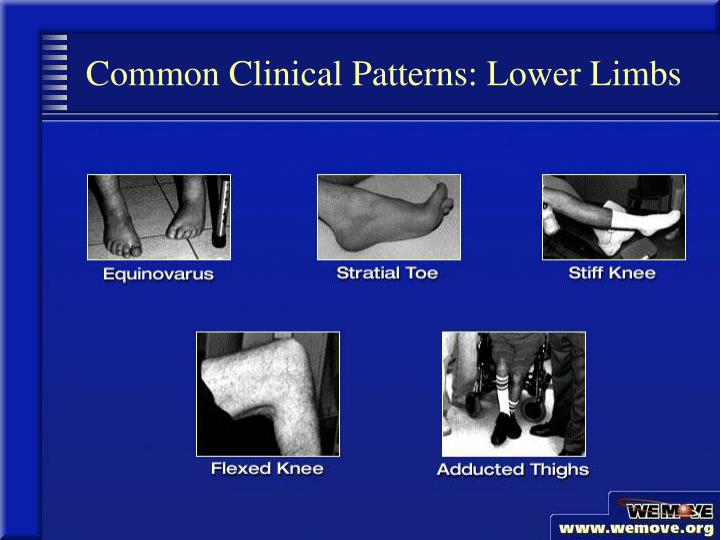 PPT - Spasticity: Evaluation and Treatment Planning PowerPoint ...