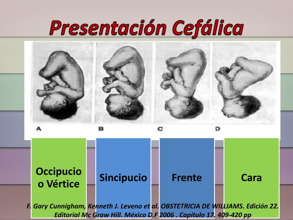PPT - Mecanismos del Trabajo de Parto PowerPoint Presentation, free ...