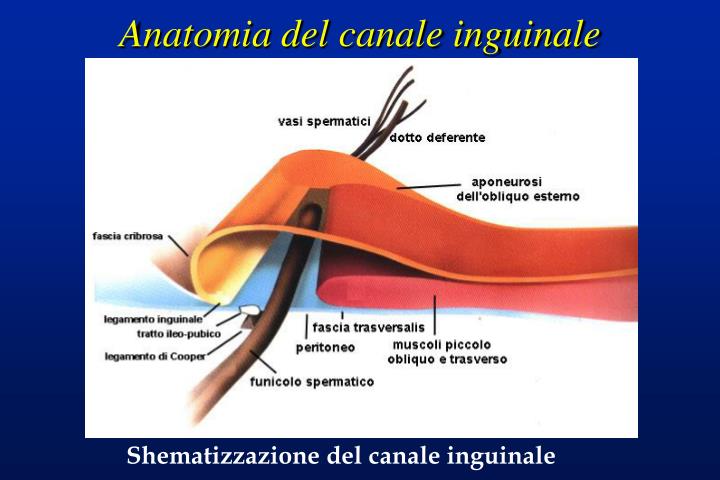 PPT - ERNIA INGUINALE PowerPoint Presentation - ID:2920007