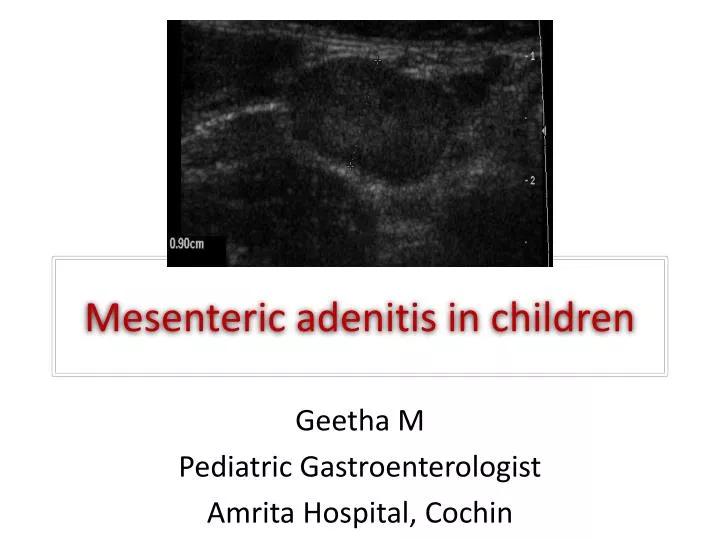 PPT - Mesenteric adenitis in children PowerPoint Presentation, free ...