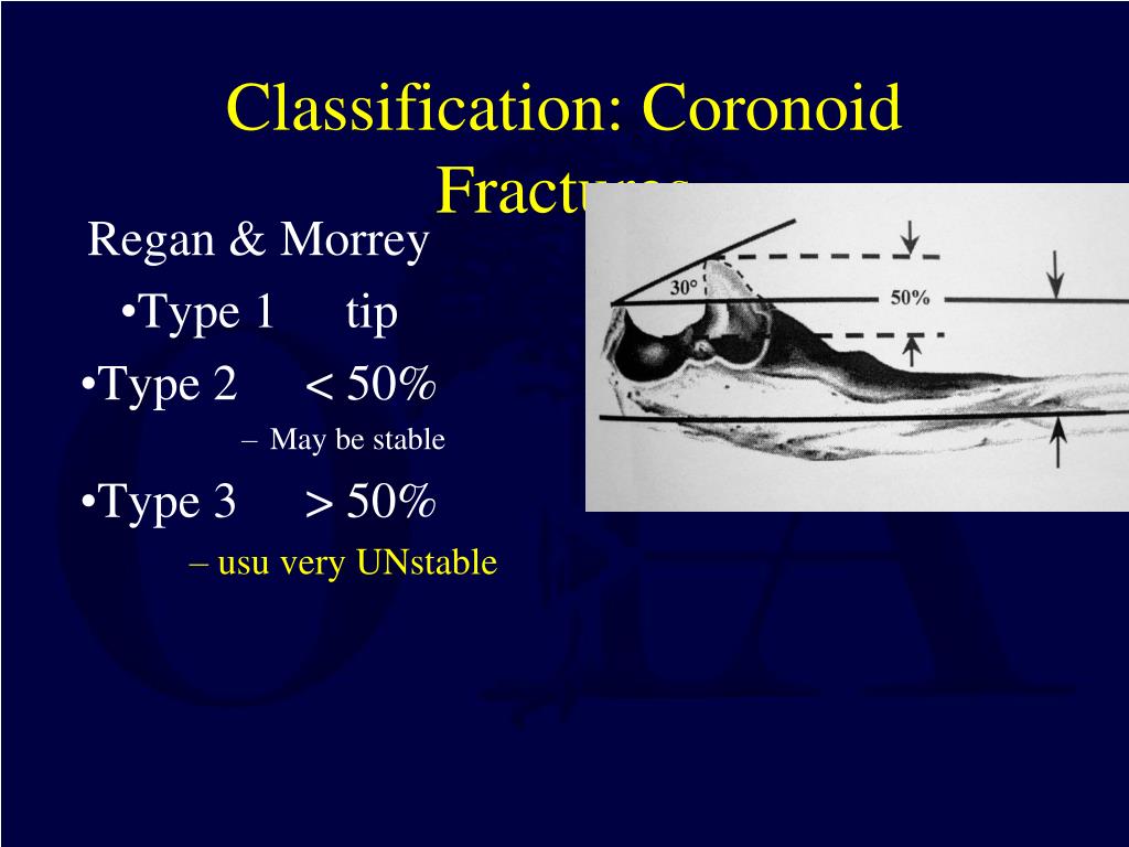 PPT - Surgical Approaches for “ Terrible Triad ” Fracture-Dislocations ...