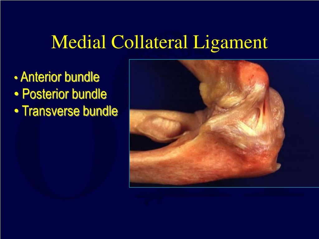 PPT - Surgical Approaches for “ Terrible Triad ” Fracture-Dislocations ...