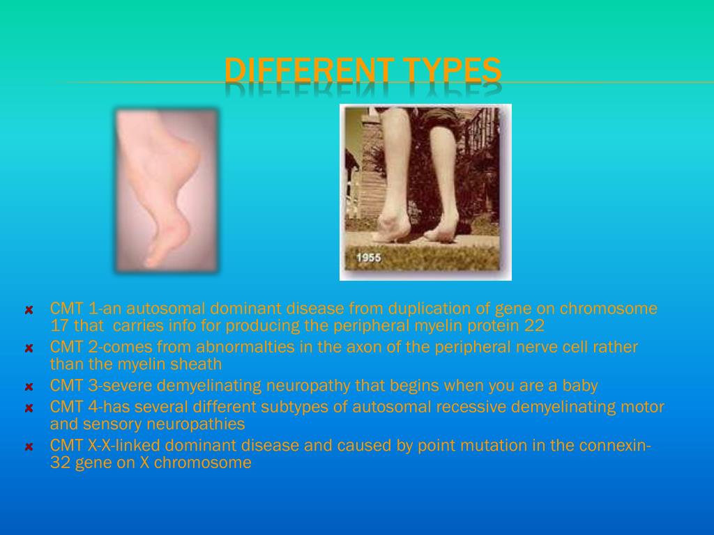 PPT - Charcot-Marie-Tooth Disease PowerPoint Presentation, free ...