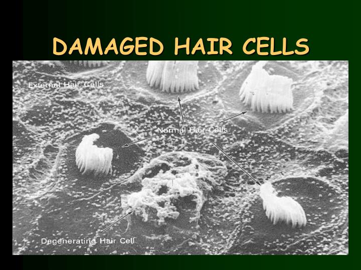 PPT - HEARING LOSS PREVENTION PowerPoint Presentation - ID:2922044
