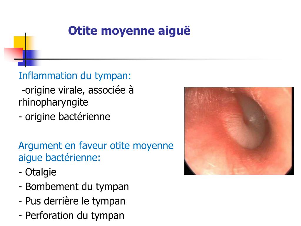 PPT - SEMIOLOGIE DE L’ENFANT ET DU NOURRISSON (3) PowerPoint ...