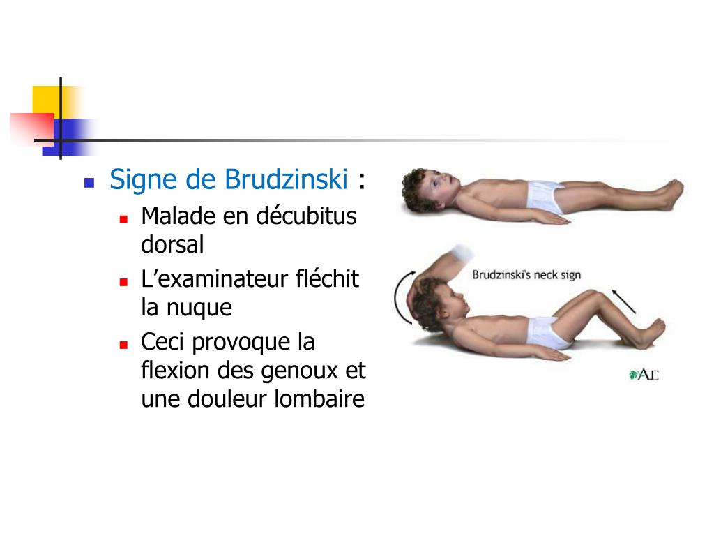 PPT - SEMIOLOGIE DE L’ENFANT ET DU NOURRISSON (3) PowerPoint ...