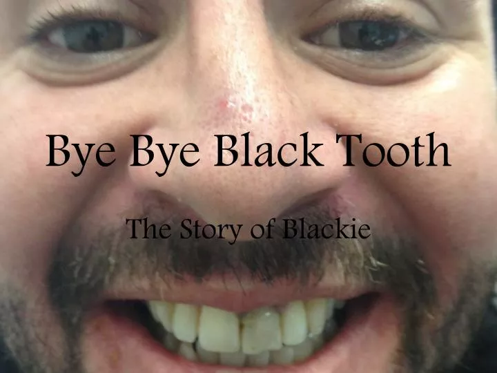 PPT - Bye Bye Black Tooth PowerPoint Presentation, free download - ID ...