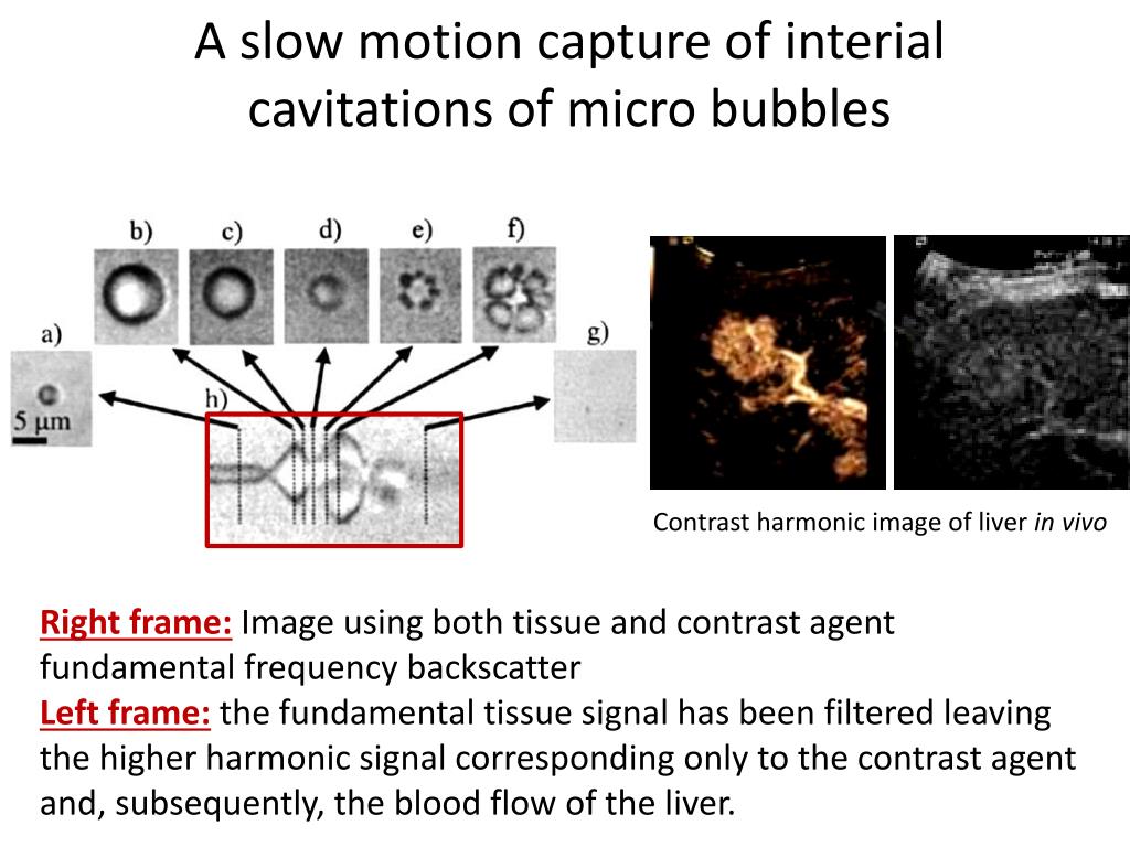 PPT - Ultrasound Imaging (Contrast Agents and Therapy) BIOE 498/598 DP ...