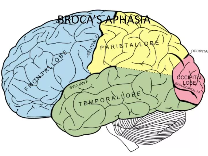 PPT - BROCA’S APHASIA PowerPoint Presentation - ID:2929468