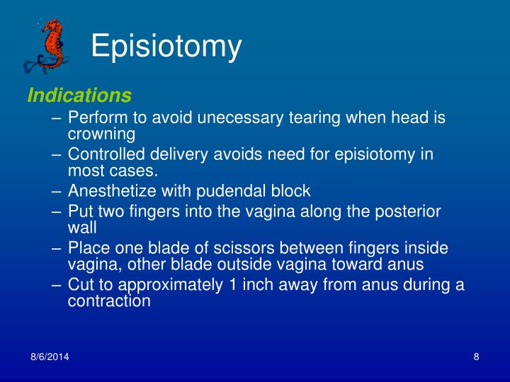 PPT - Management of the second stage of labor PowerPoint Presentation ...