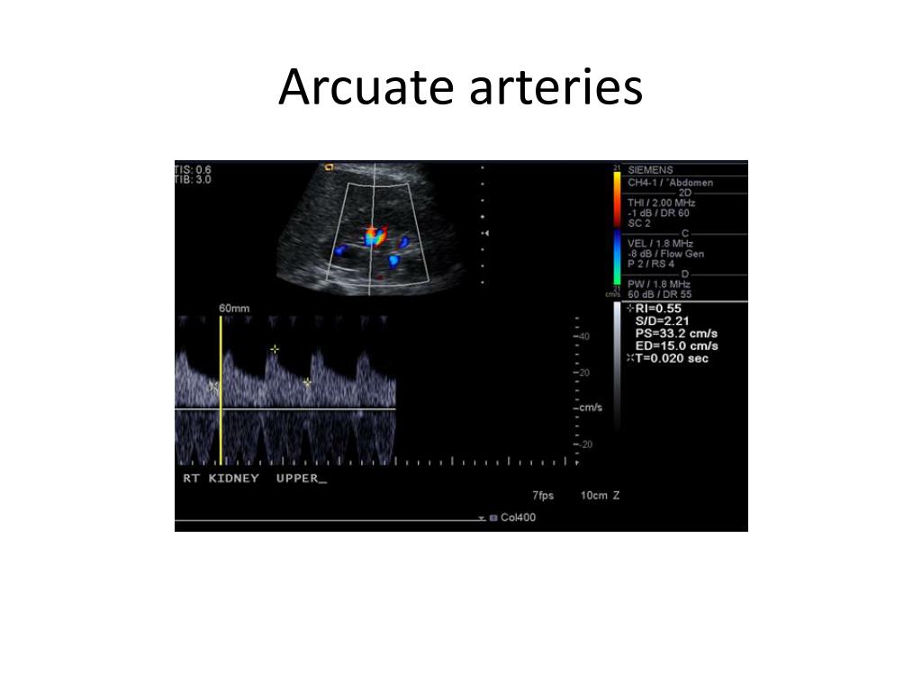 PPT - Renal artery Ultrasound study PowerPoint Presentation, free ...