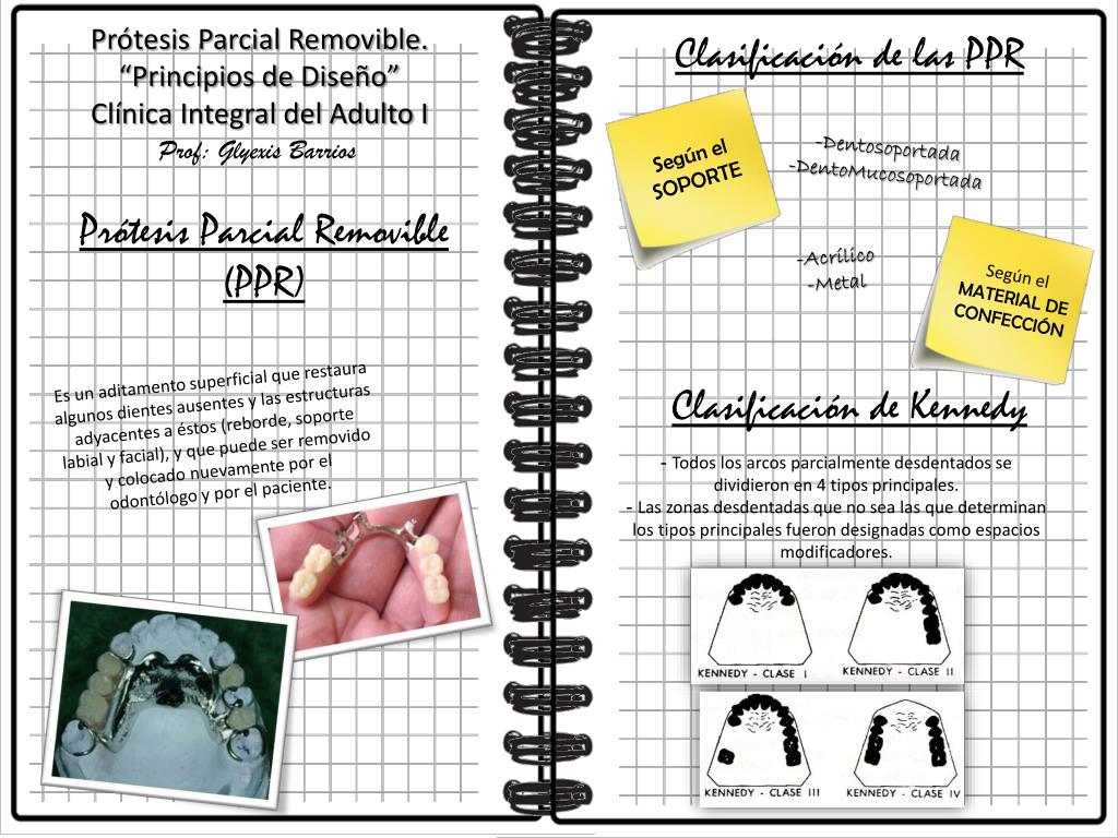 PPT - Prótesis Parcial Removible. “Principios de Diseño” Clínica ...