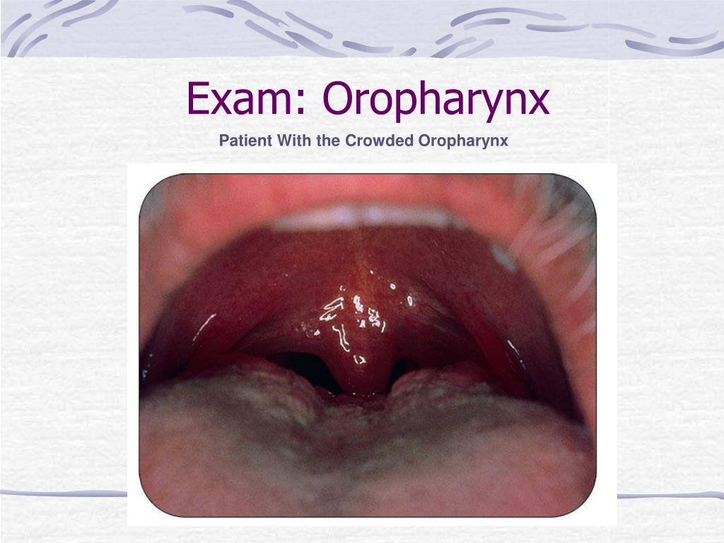 PPT - Perioperative Management of the Sleep Apnea Patient PowerPoint ...