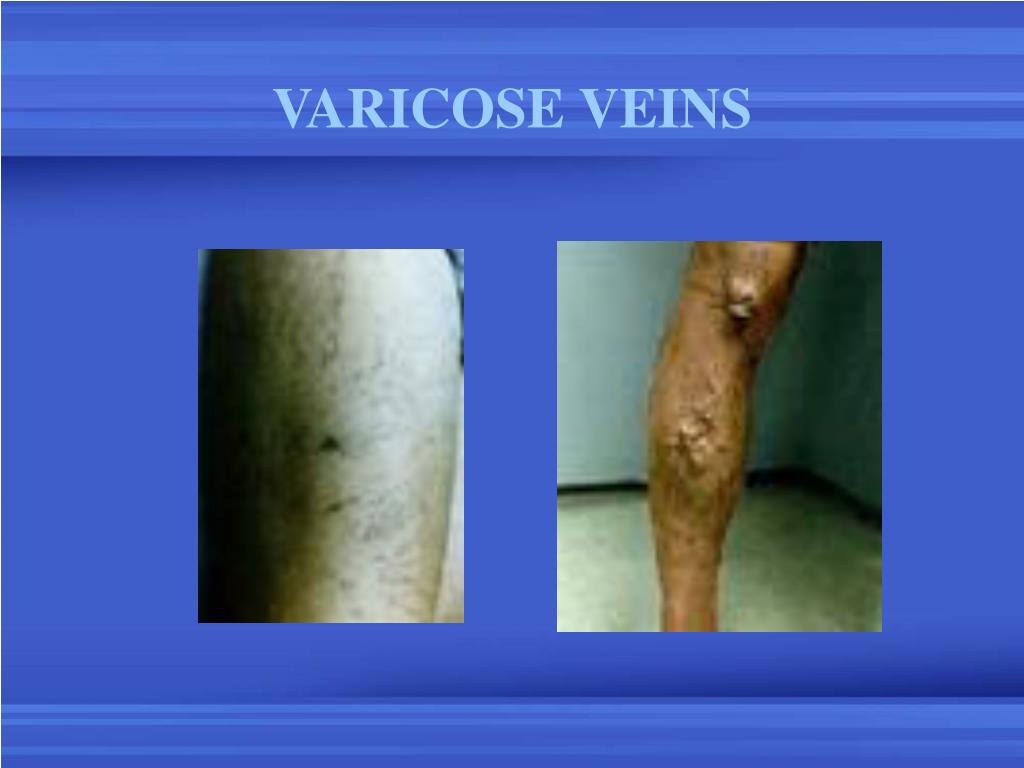 PPT - Functional Anatomy of Blood Vessels PowerPoint Presentation, free ...