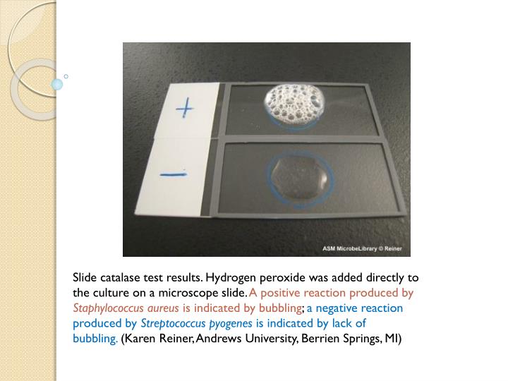 PPT - Ex. 5-4 Catalase test PowerPoint Presentation - ID:2939256