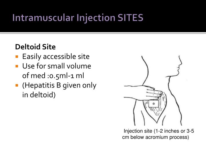 PPT - Medication Administration PowerPoint Presentation - ID:2939504