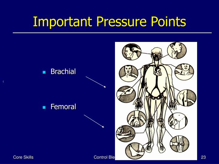 PPT - HEMORRHAGE CONTROL PowerPoint Presentation - ID:2939518
